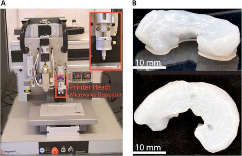 Estudo escocês analisa a impressão 3D de próteses da anca – Faditiva