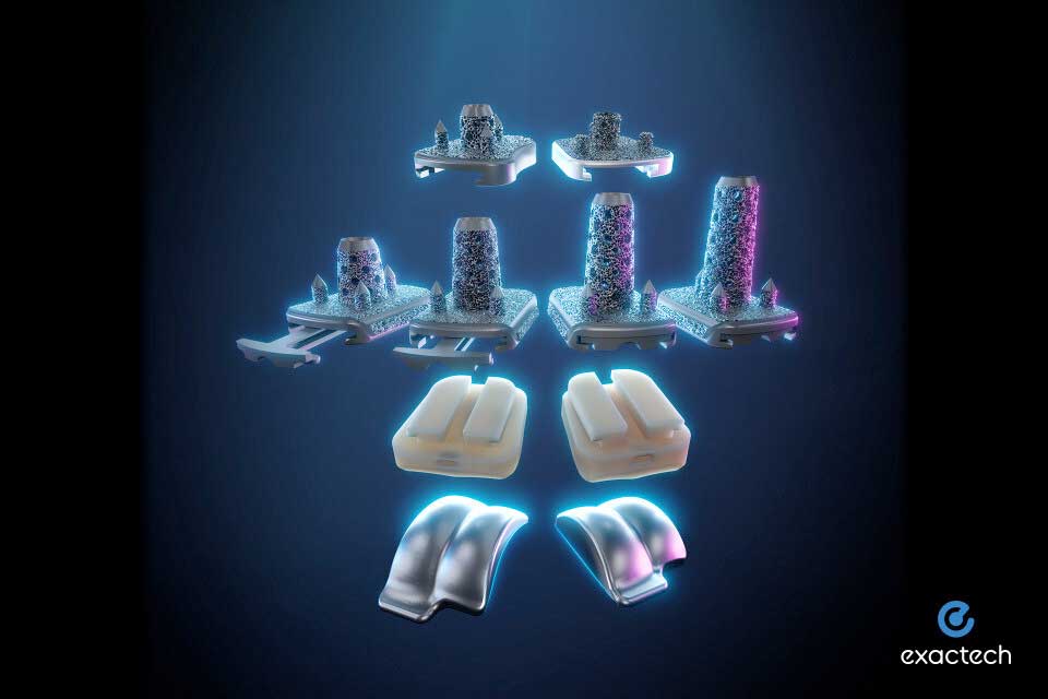 A Exactech anuncia as primeiras cirurgias totais do tornozelo com novos ...